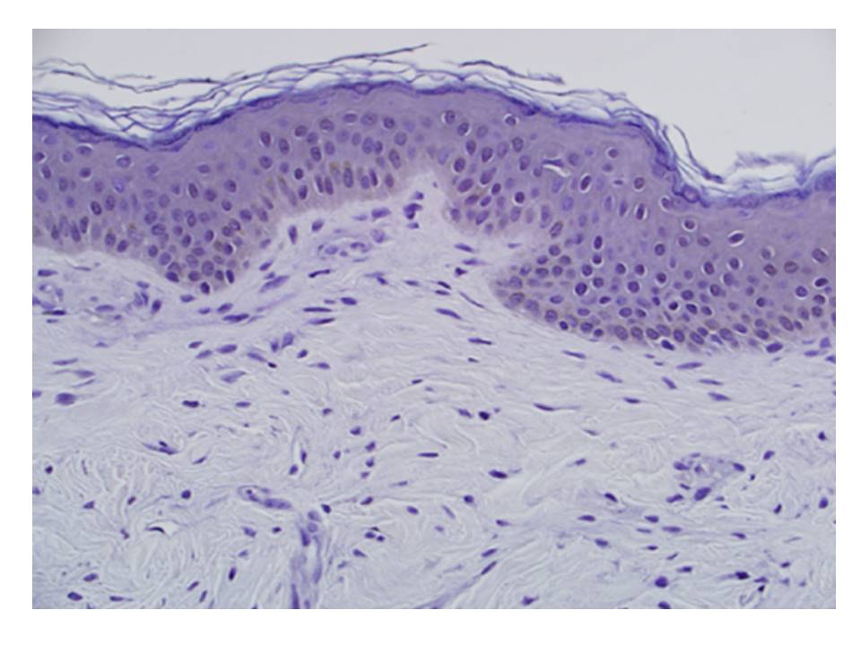 Our Services – Beviglia Cancer Models.com