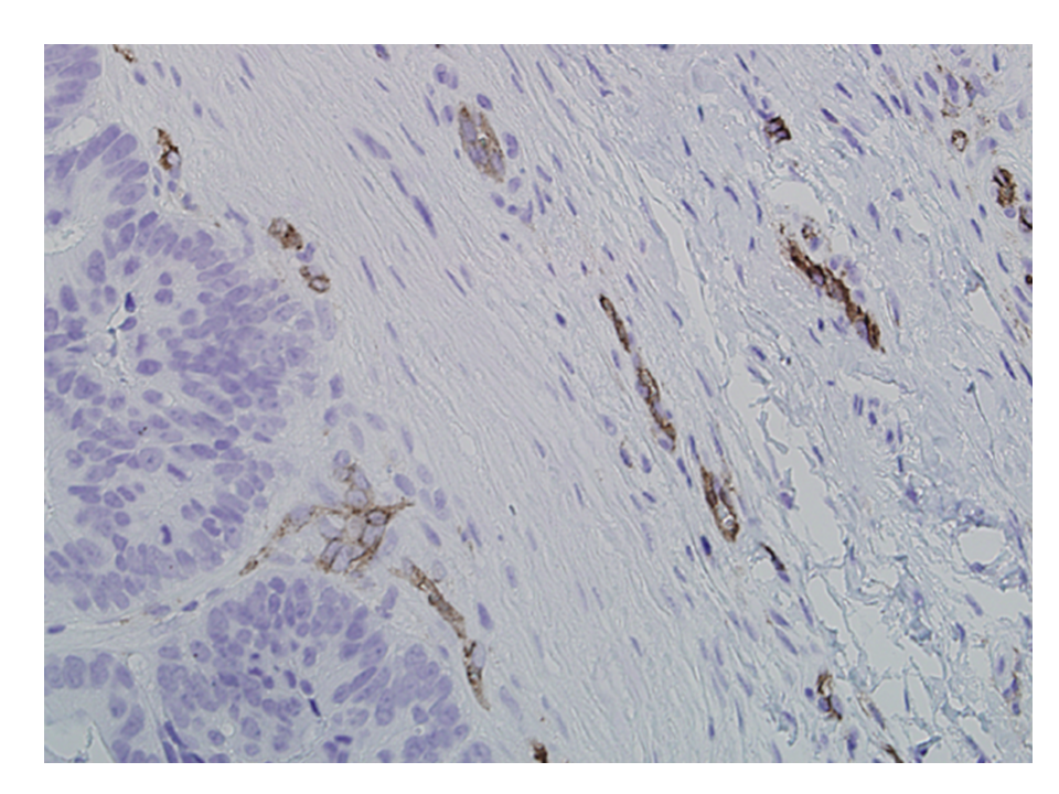 Our Services – Beviglia Cancer Models.com